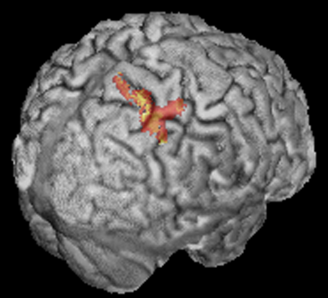 How Mental Fatigue Impacts Physical Endurance: Boost Your Performance ...